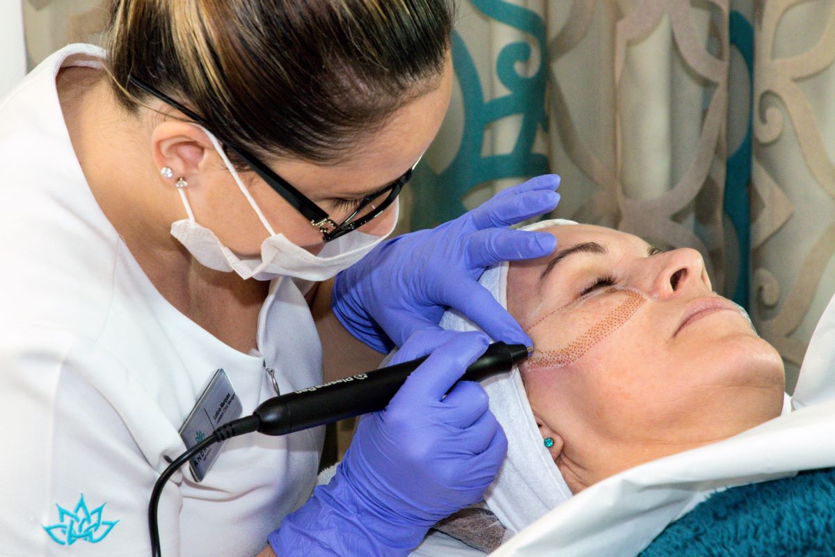 The Fibroblast Plasma Lift - Andresa Aesthetics | Exclusive Skin Health ...