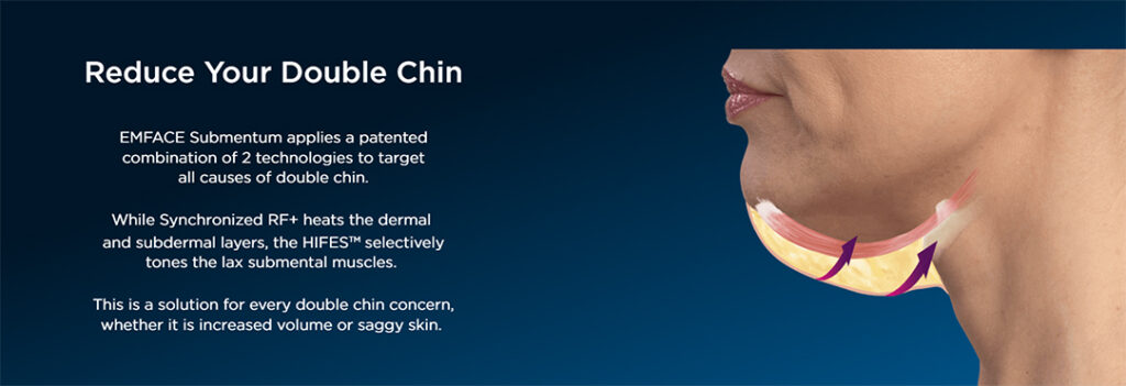 BTL EMface - Andresa Aesthetics | Exclusive Skin Health and Laser ...